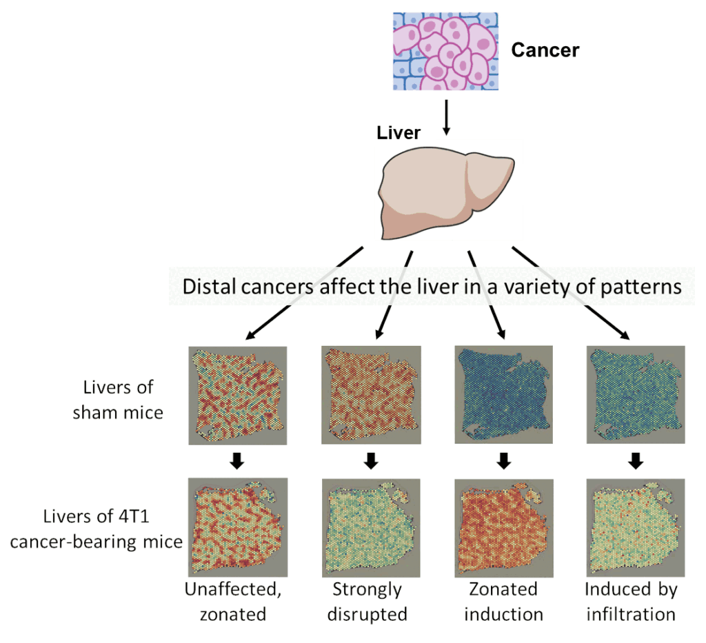 Murine breast cancers disorganize the liver transcriptome in a zonated ...